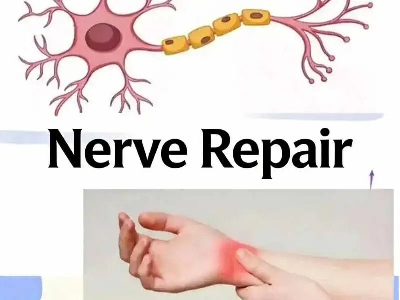 HBOT for Bell's Palsy - BaoBang